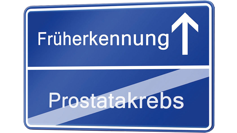 Digital-rektale Untersuchung (DRU) – so läuft das Abtasten der Prostata ab